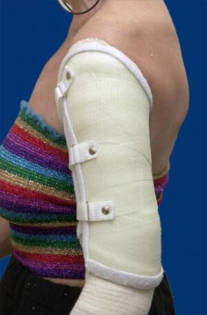 Bovenarm brace (Sarmiento brace) - ZorgSaam