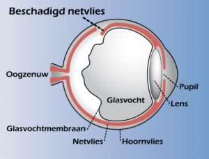 Lichtflitsen - ZorgSaam