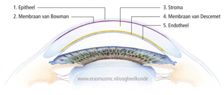 Cornea endotheel dystrofie (Erfelijke aandoeningen van het hoornvlies ...